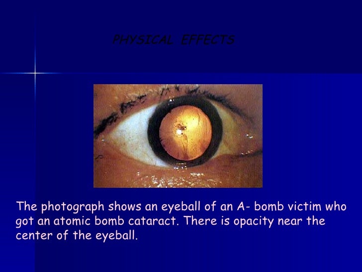 Hiroshima And Nagasaki