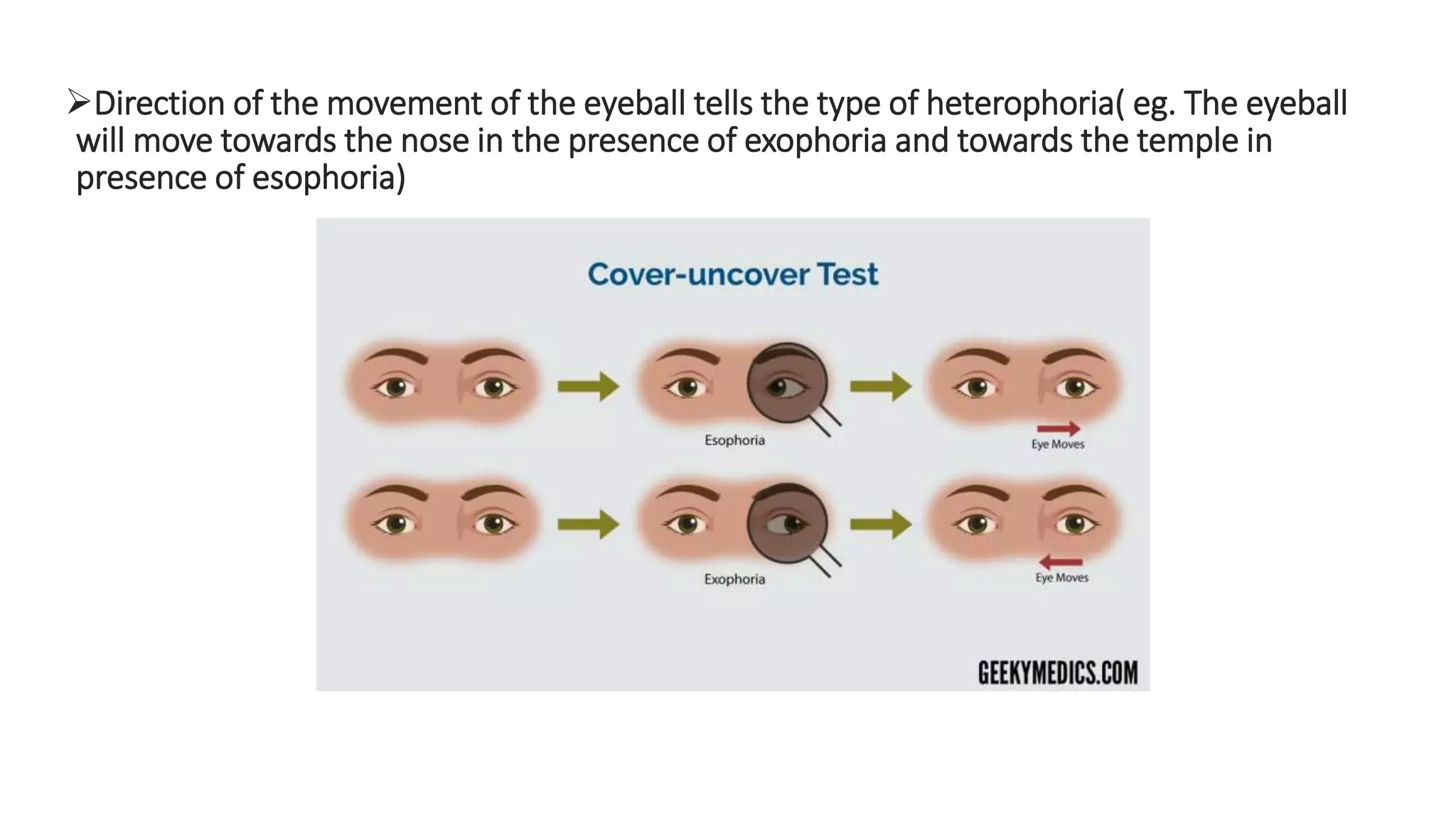Hirschberg and krimsky test.pptx