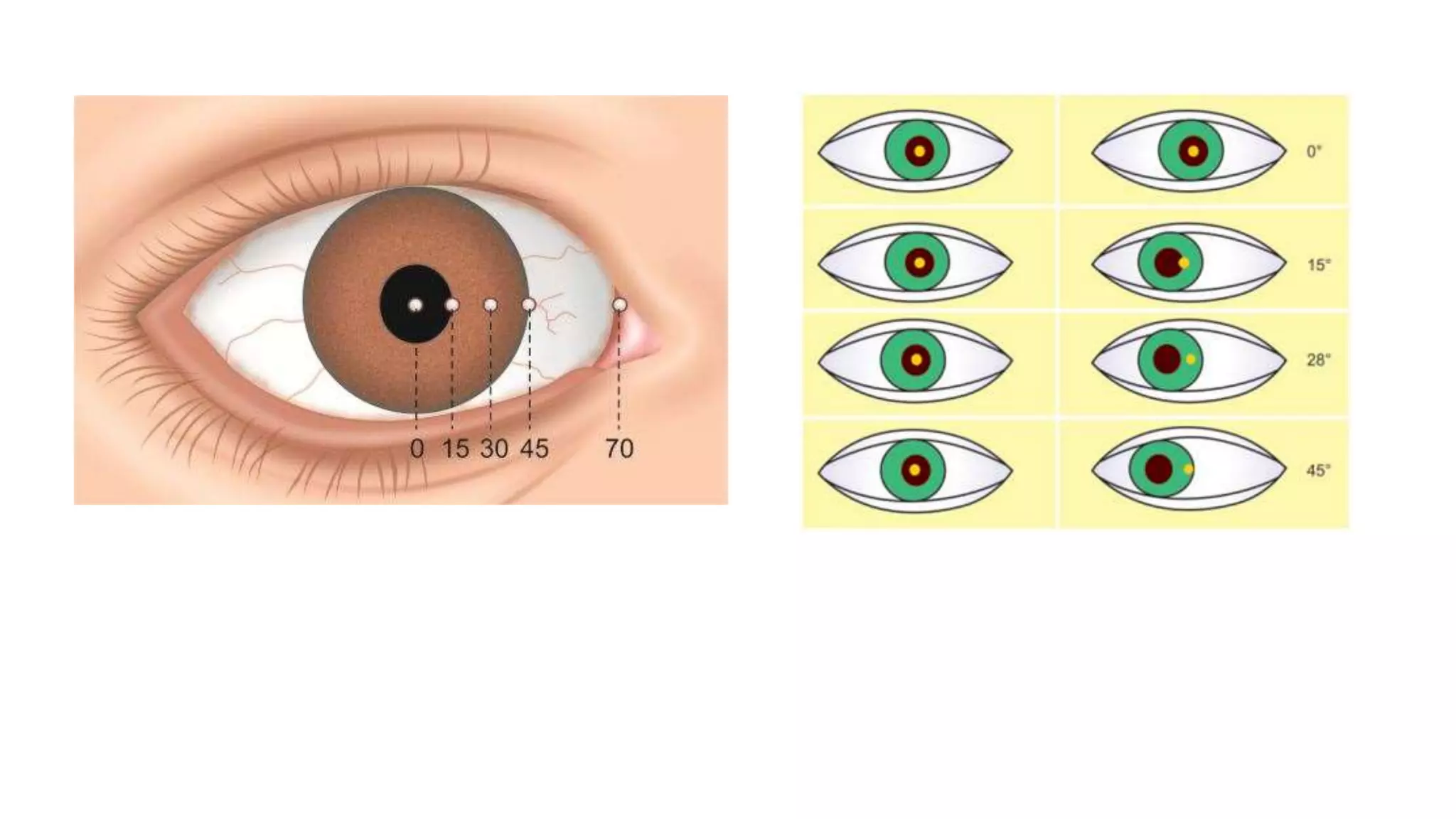 Hirschberg and krimsky test.pptx | Eye and Vision Conditions | Diseases ...