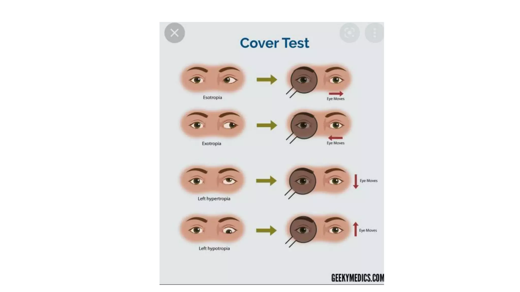 Hirschberg and krimsky test.pptx