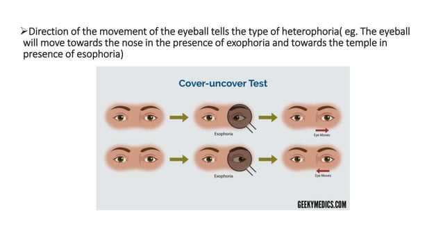 Hirschberg and krimsky test.pptx | Eye and Vision Conditions | Diseases ...