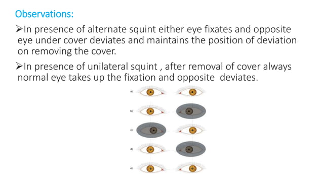 Hirschberg and krimsky test.pptx | Eye and Vision Conditions | Diseases ...