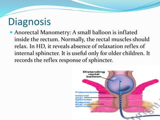 Hirschprung disease.pptx
