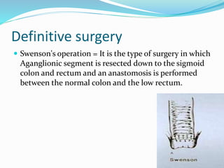 Hirschprung disease.pptx