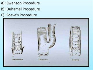 Hirschsprung disease | PPT