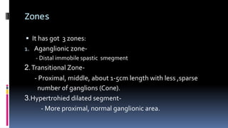 Hirschsprung disease | PPT