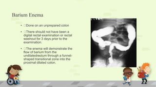Hirschsprung disease | PPTX | Digestive Disorders | Diseases and Conditions