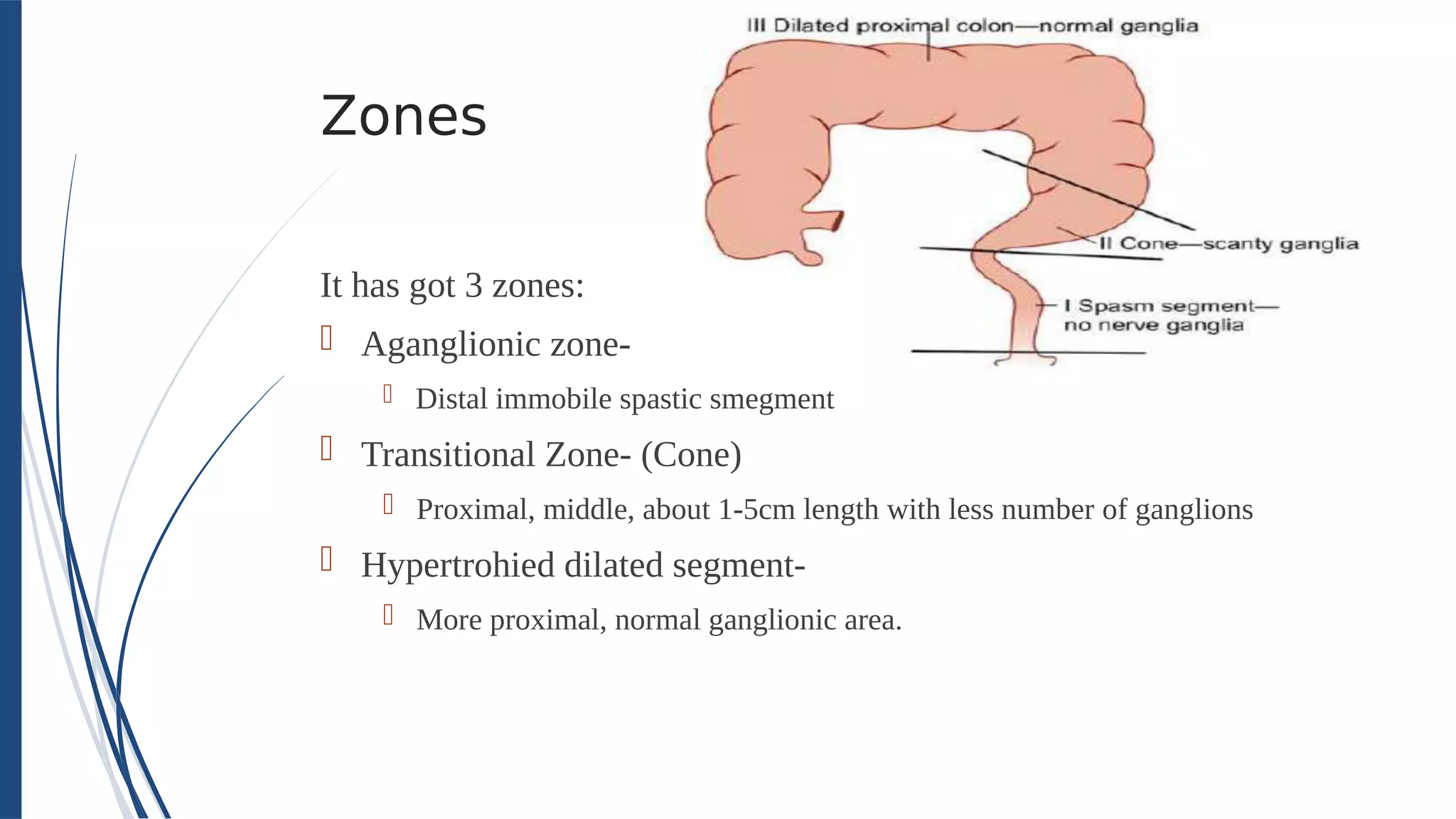 Hirschsprung Disease - Approach & Management | PDF | Digestive ...