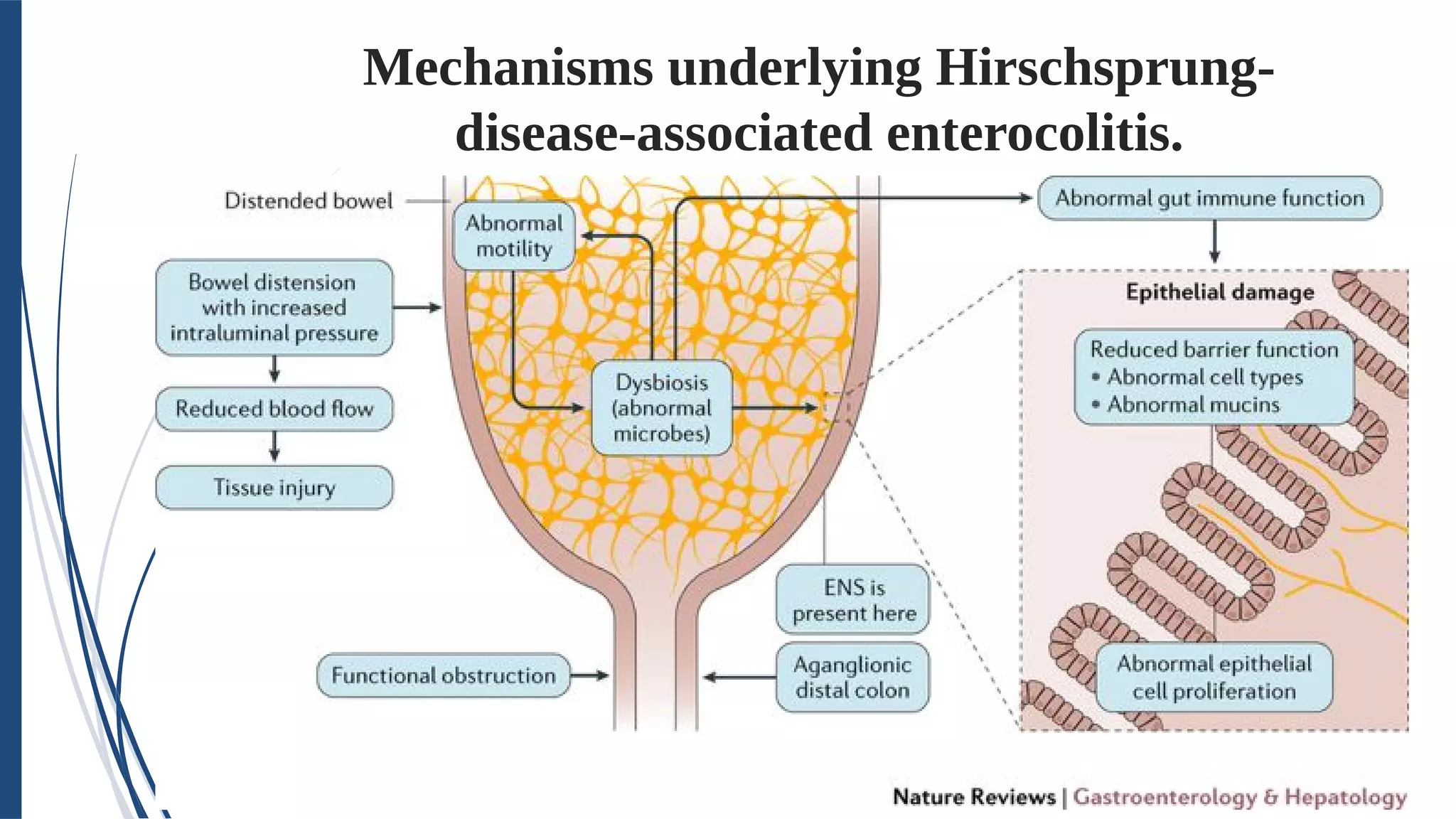 Hirschsprung Disease - Approach & Management | PPT