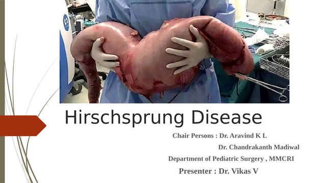 Hirschsprung Disease Approach And Management Ppt
