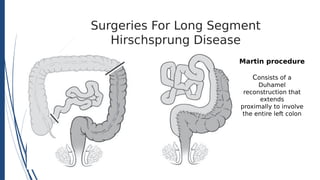 Hirschsprung Disease - Approach & Management | PPT