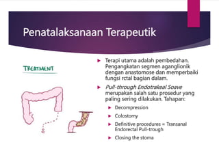 Hirschsprung_Disease.pptx