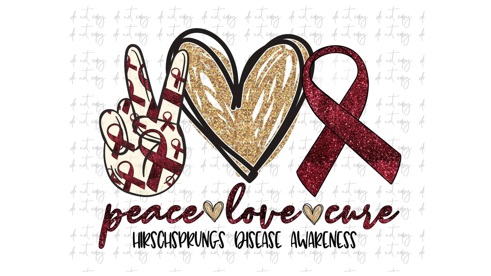 HIRSCHSPRUNG DISEASE.pdf AGANGLIONIC MEGACOLON, CONGENITAL MEGACOLON | PDF