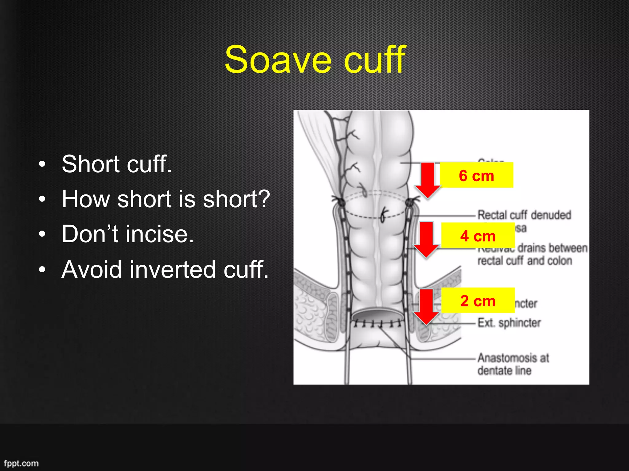 Hirschsprung disease avoiding complications | PDF