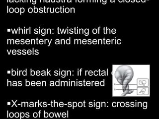 Hirschsprung's disease.pptx