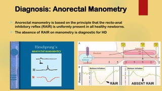 surgery - of Hirschsprung’s Disease.pptx