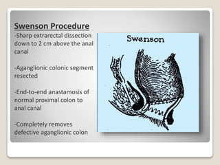 Hirschsprung's disease by dr abhinav kesarwani | PPT