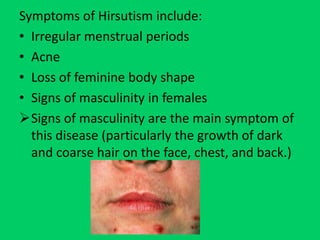 Hirsutism | PPTX