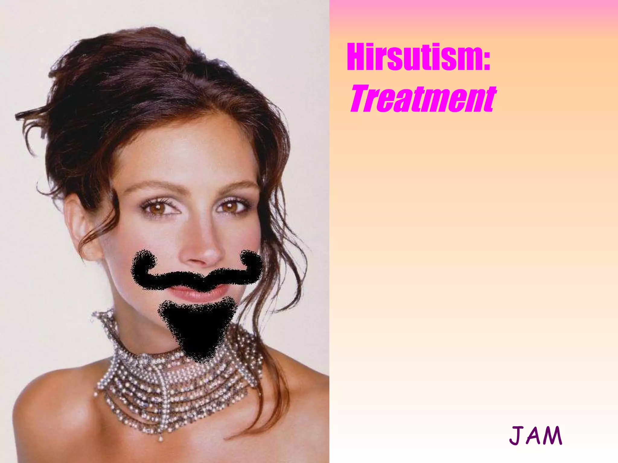 Hirsutism | PPT