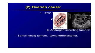 Hirsutism and virilism /. pdf | PDF