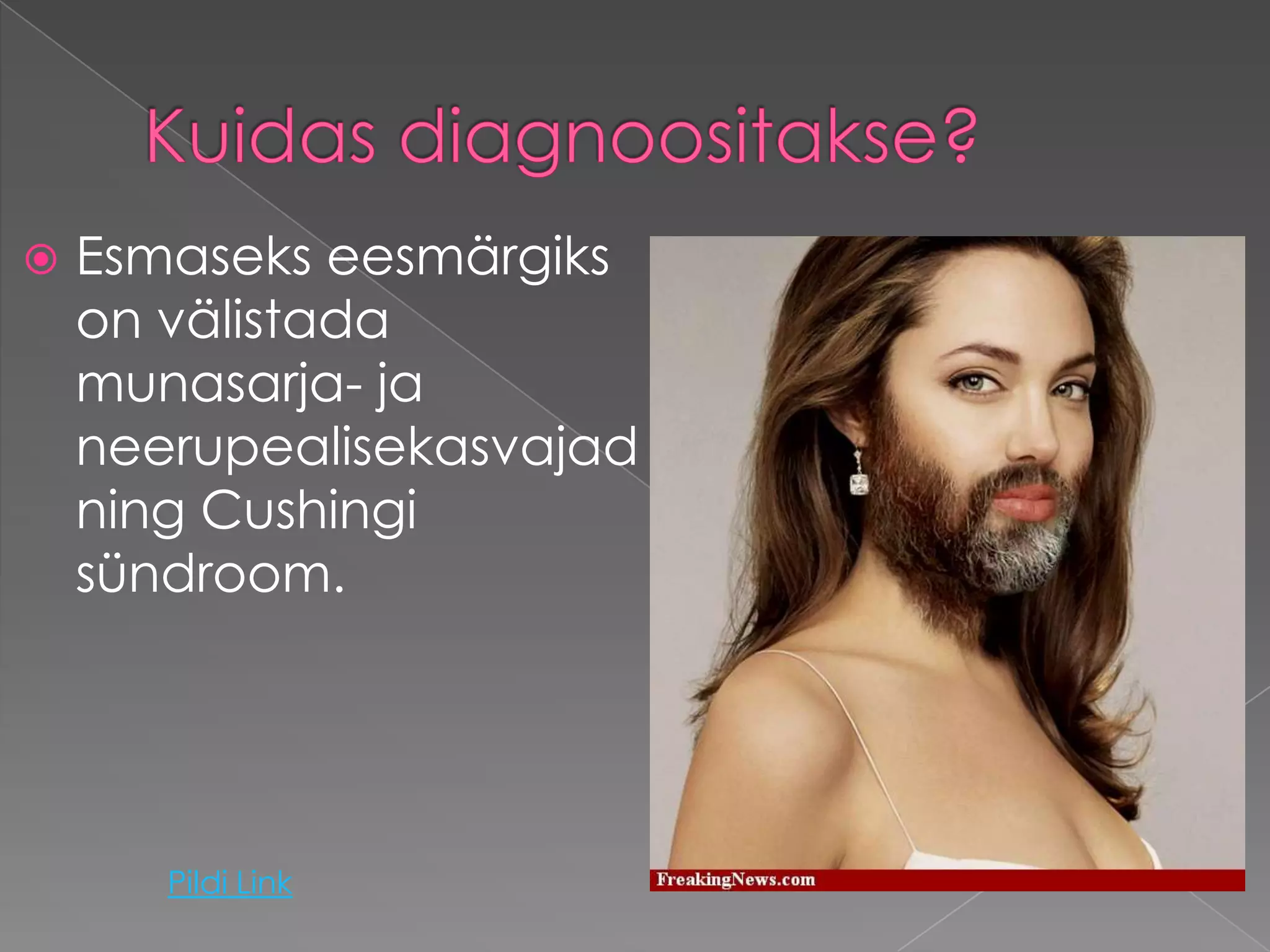 Hirsutism | PPTX