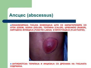 Hirurshki infekcii slide show presentation.pdf