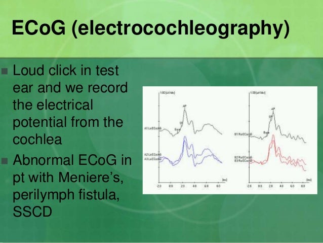 His 120 vestibular disorders