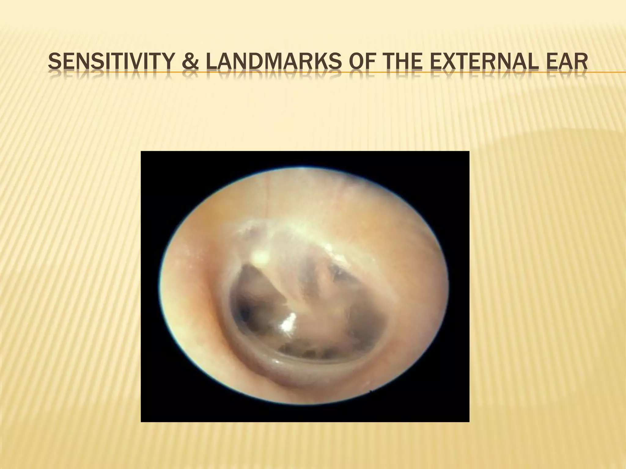 His 125 auditory sensitivity and landmarks of the external ear | PPT