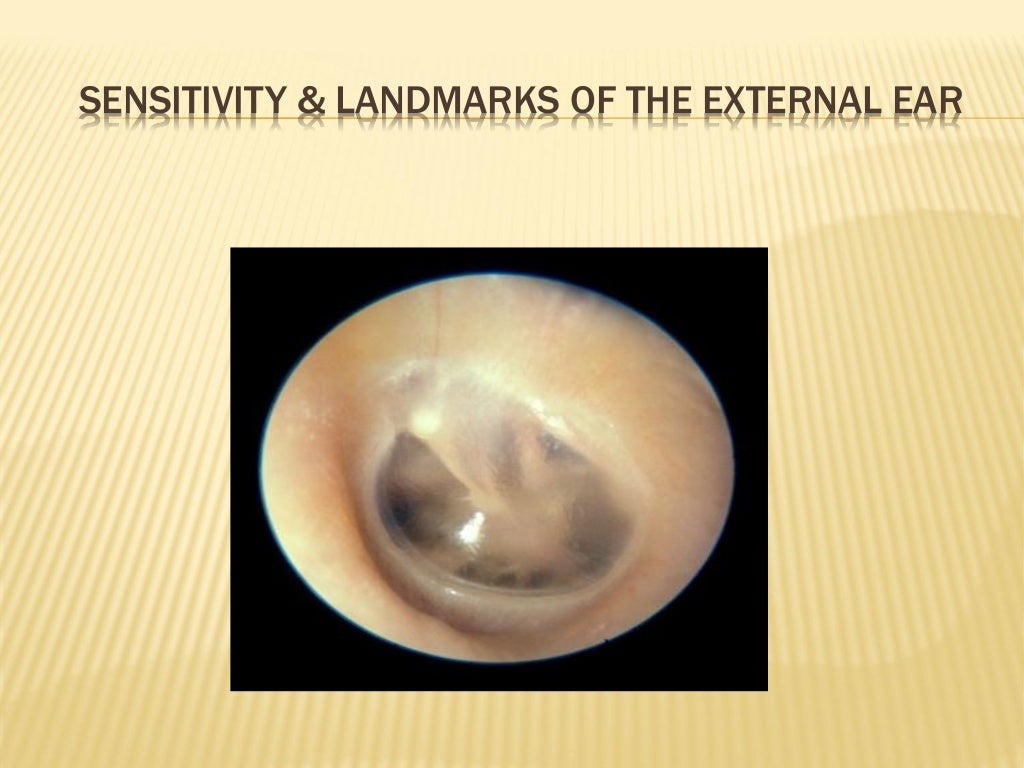 HIS 125 Auditory Sensitivity and Landmarks of the External Ear