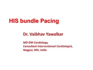 His bundle pacing by Dr. Vaibhav Yawalkar MD DM Cardiology, Consultant ...
