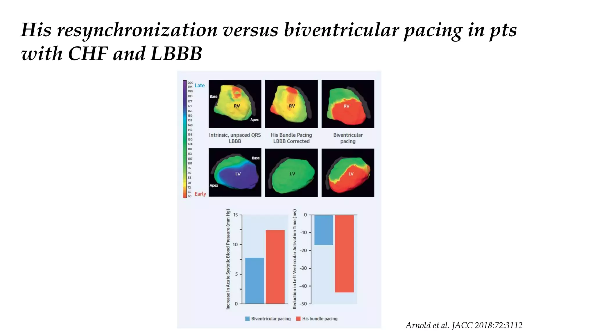 His bundle pacing as cardiac resynchronization therapy | PPTX