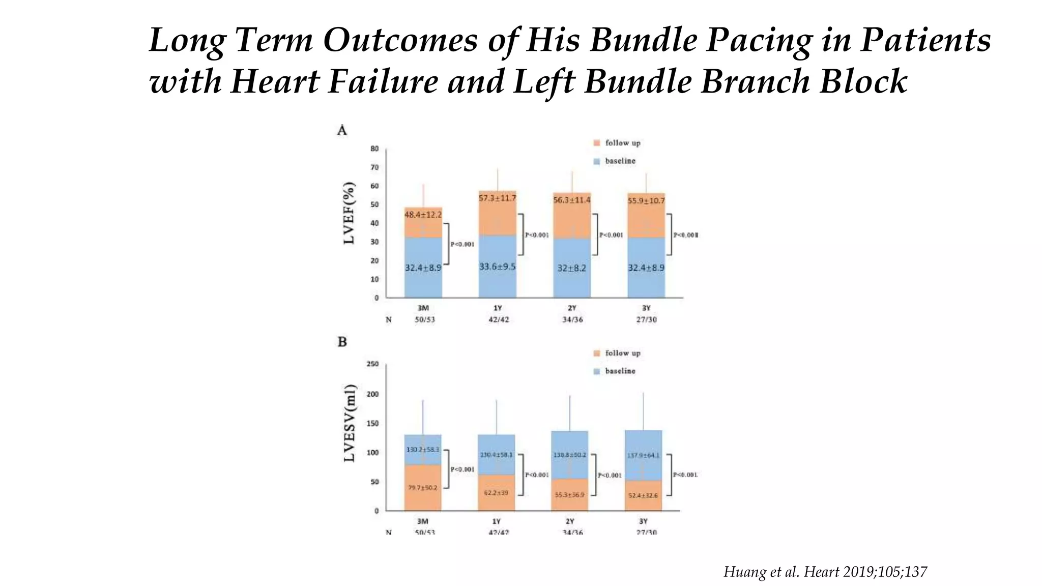 His bundle pacing as cardiac resynchronization therapy | PPTX