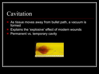 Wound Ballistics and Body Armor Paper Presentation | PPT