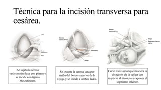 Histerectomia | PPTX