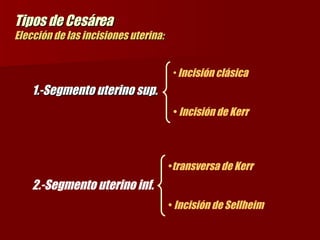 histerectomia obstetrica. TIPOS CAUSAS CLASE | PDF