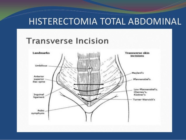 Histerectomia total abdominal tecnica quirúrgica