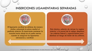 Histerectomia Vaginal y abdominal, residencia de obstetricia y ...