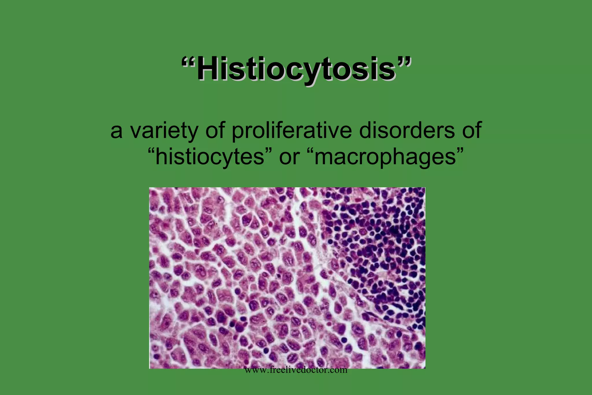Histiocytosis | PPT