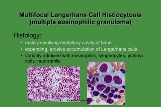 Histiocytosis | PPT