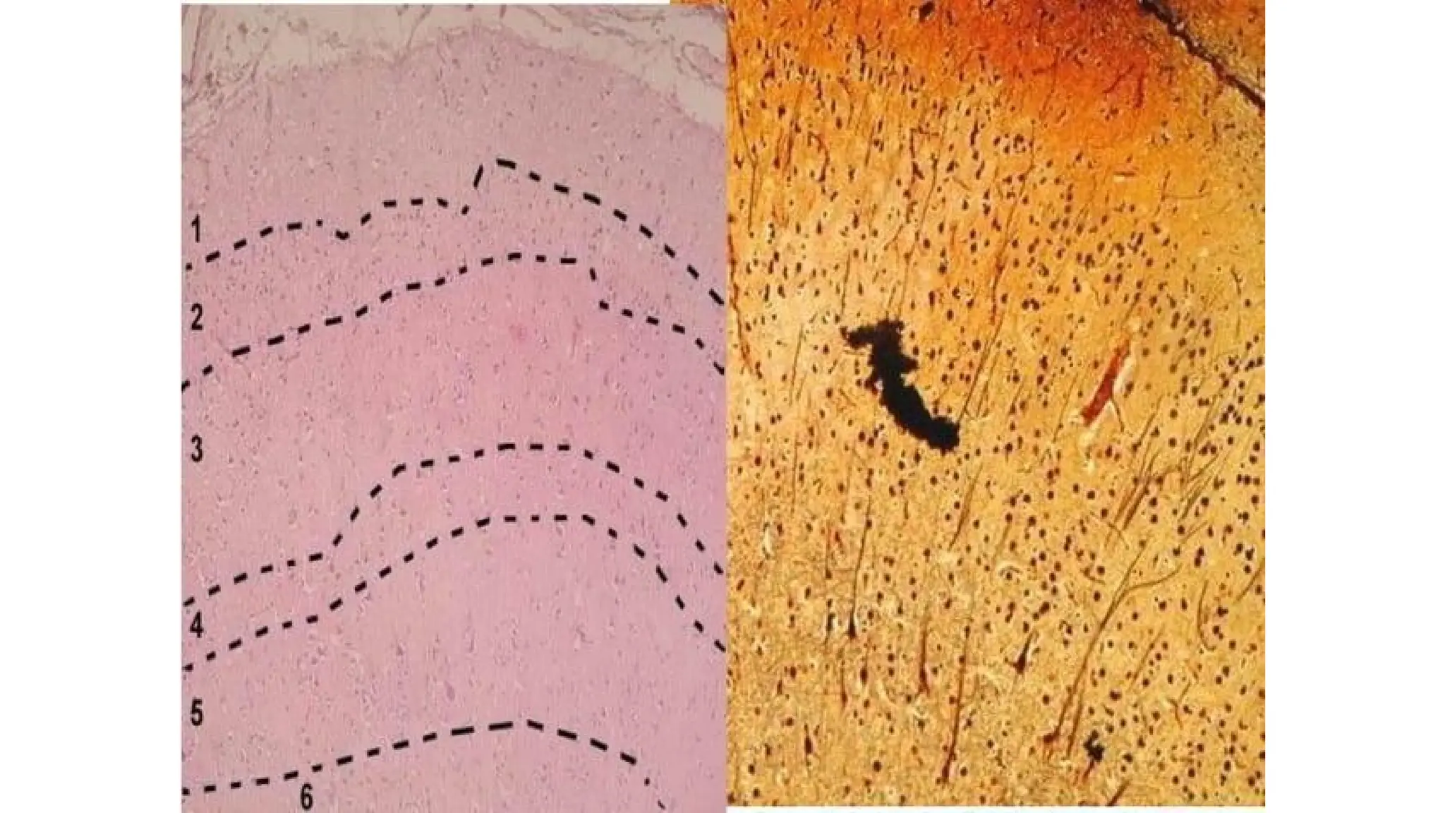 HISTO CEREBRUM,The layers of the cerebrum | PPT