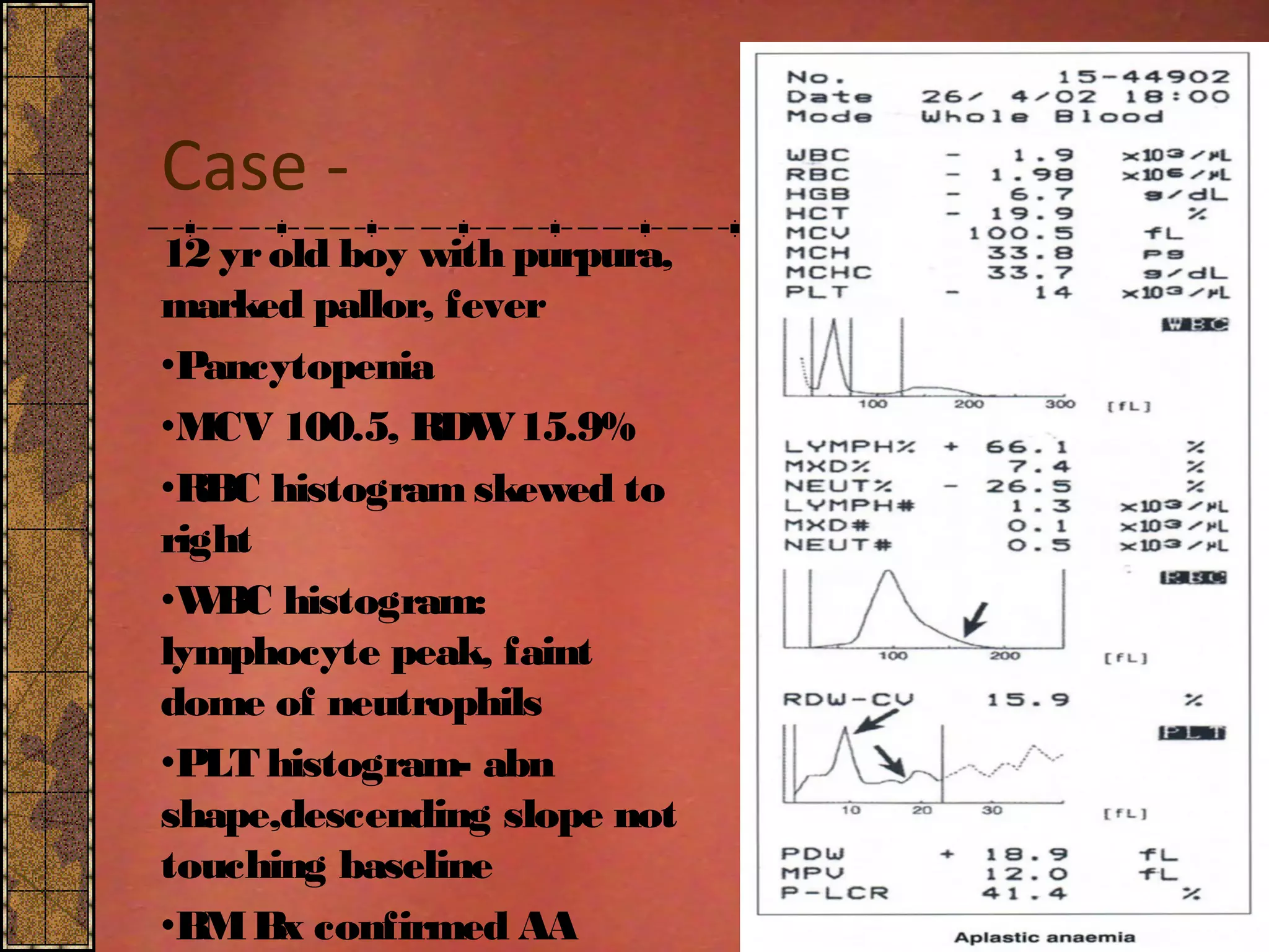 CBC Histogram DR NARMADA PRASAD TIWARI | PPT