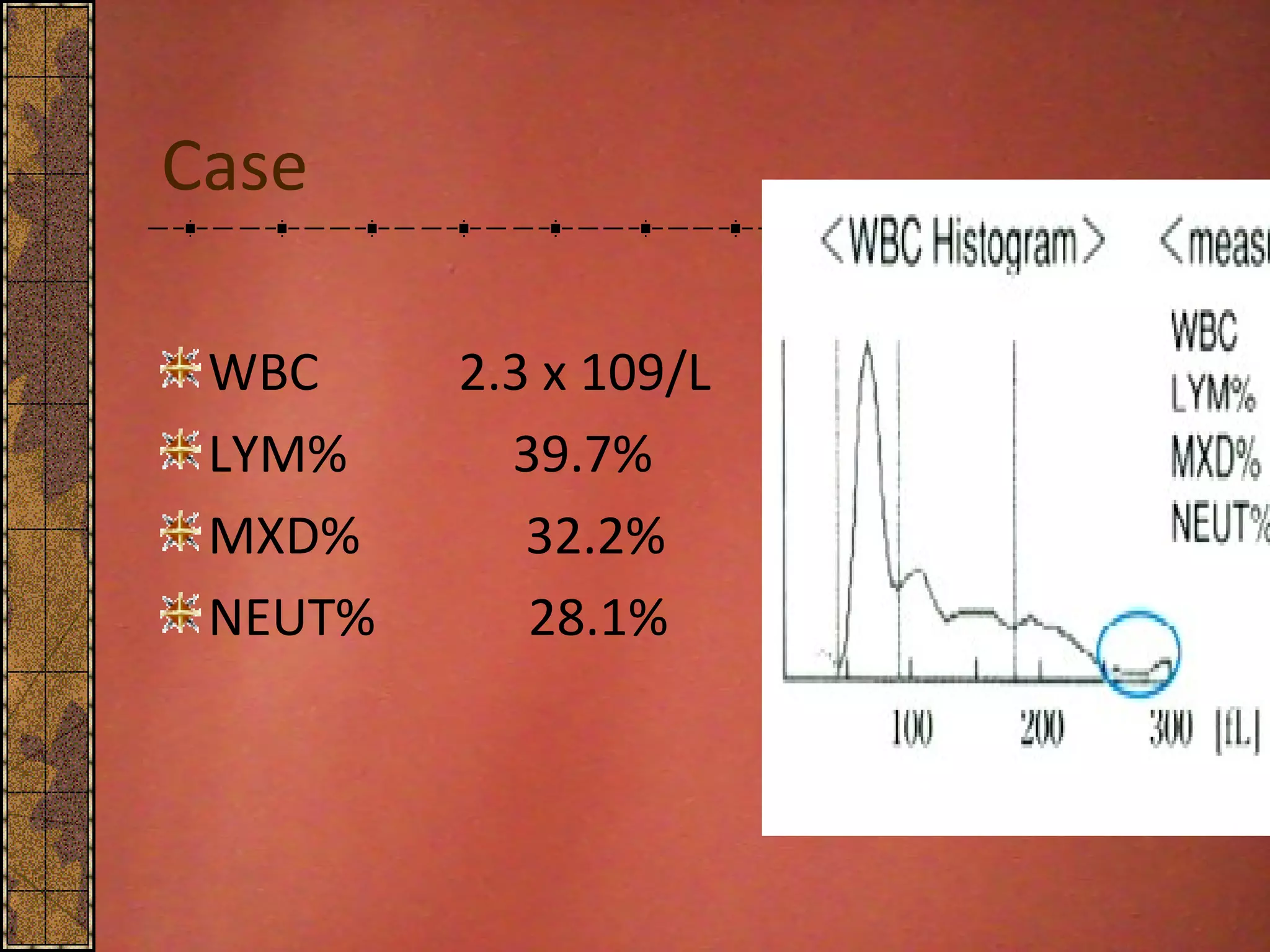 CBC Histogram DR NARMADA PRASAD TIWARI | PPT