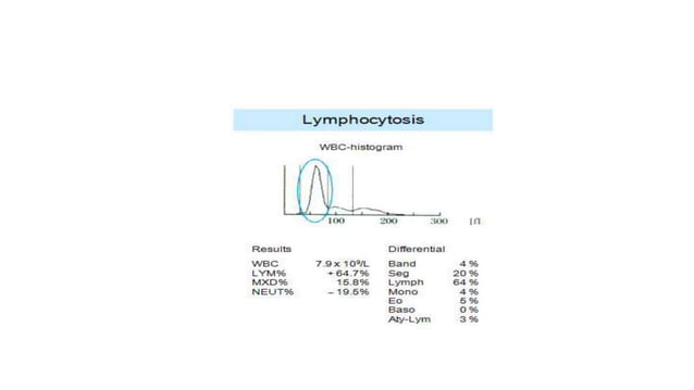 cbc Histogram | PPTX