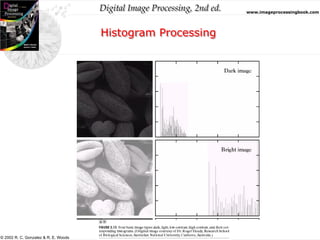 Histogram equalization and matching - Digital Image Processing | PPTX