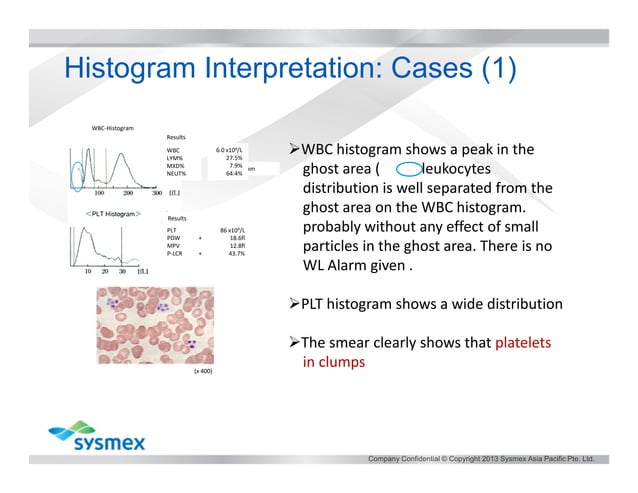 Histogram Interpretation for result analysis | PDF
