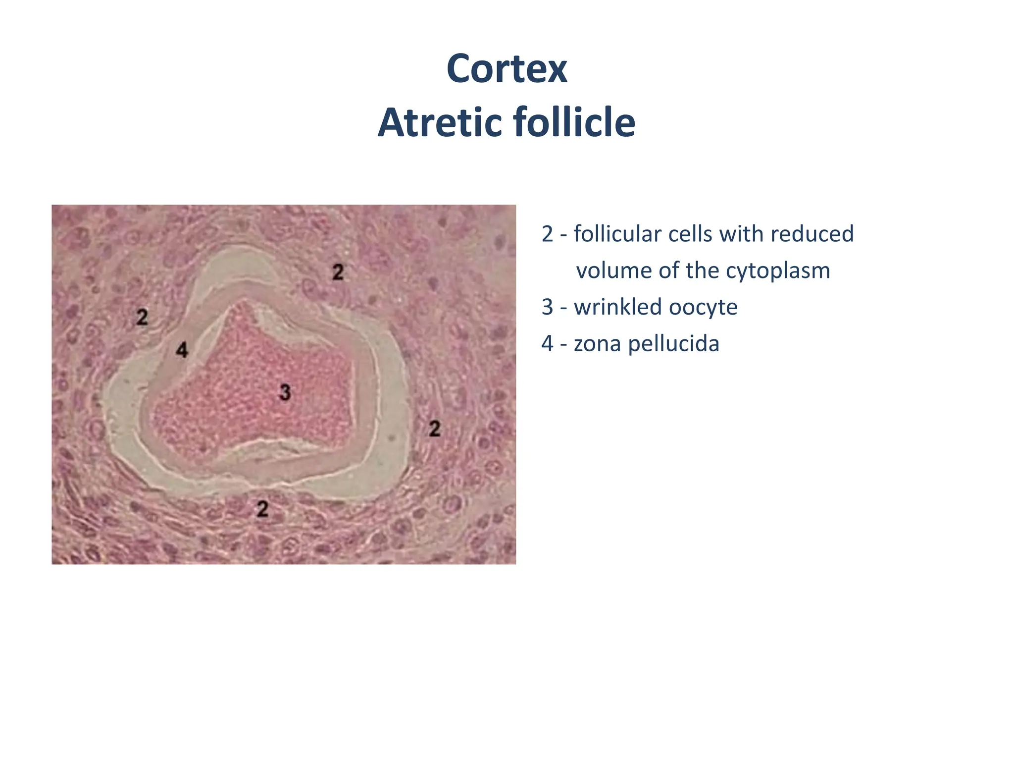 microscopic structure of ovary with diagram | PPTX
