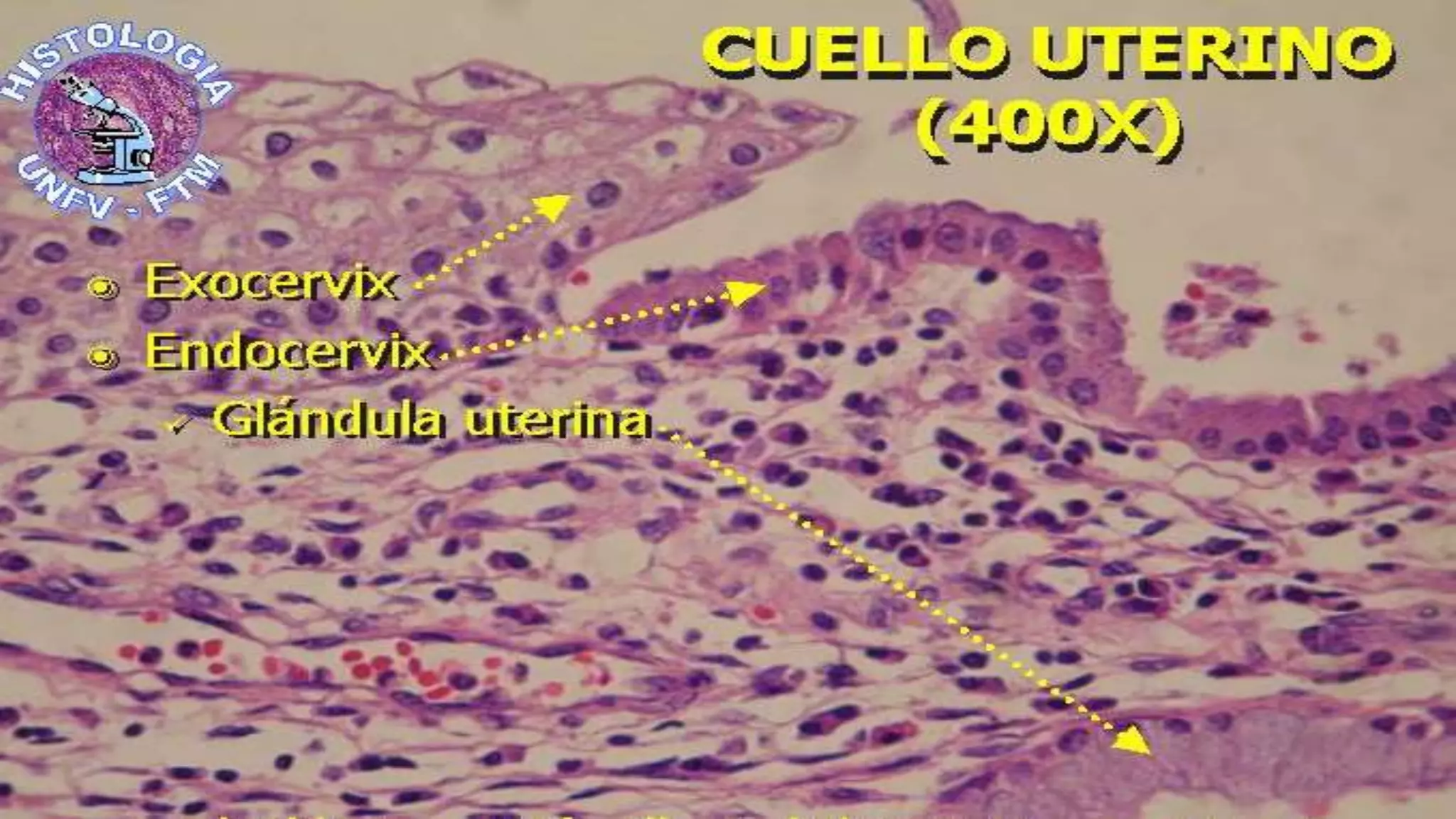 Histología del cérvix uterino y vagina | PPTX