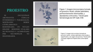 histología vaginal exposición básica .pptx