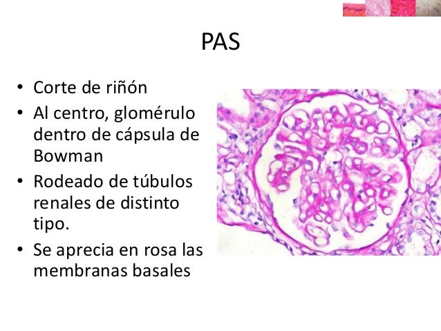 Histología tinción (histology staining)