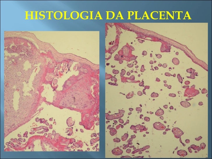 Histologia Da Placenta